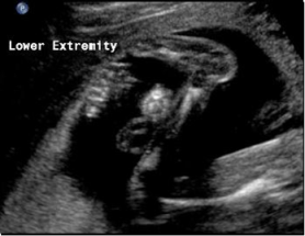 OB Images