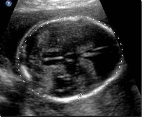 OB Images