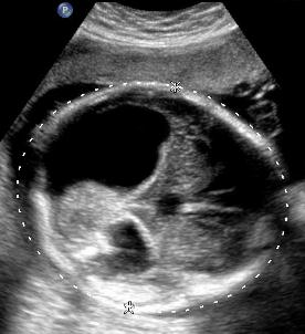 OB Images