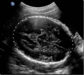 7.Absent CSP0 | OB Images