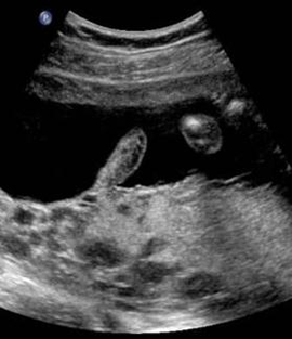 OB Images