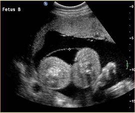 OB Images