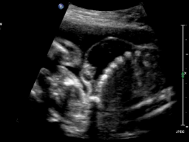OB Images