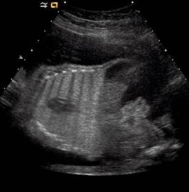 OB Images