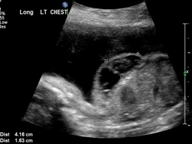 OB Images