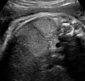 OB Images
