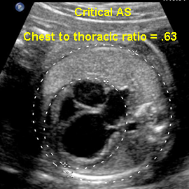 9.AS.CTratio | OB Images