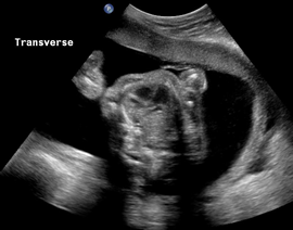 OB Images
