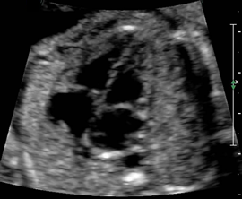 OB Images