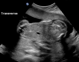 OB Images