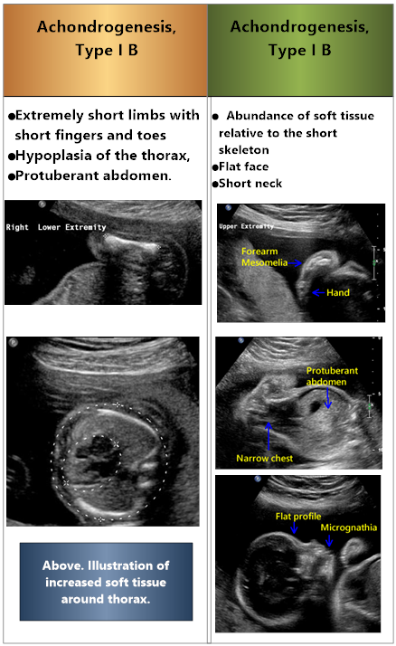 OB Images
