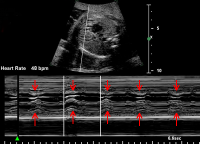 OB Images