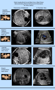 Fetal Head Anatomy Fetal Head Anatomy