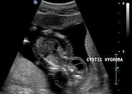 OB Images