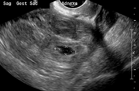 OB Images