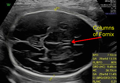 OB Images