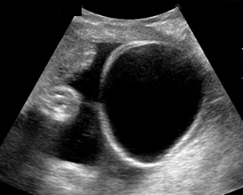 OB Images