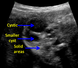 OB Images