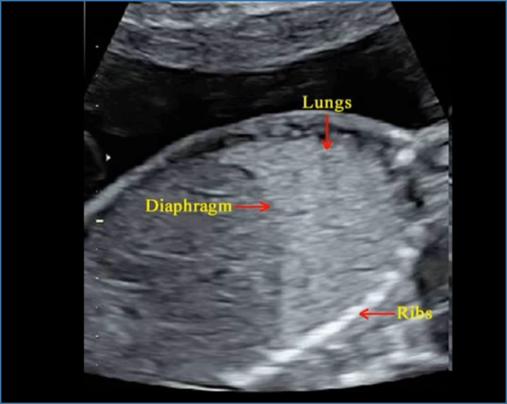 OB Images